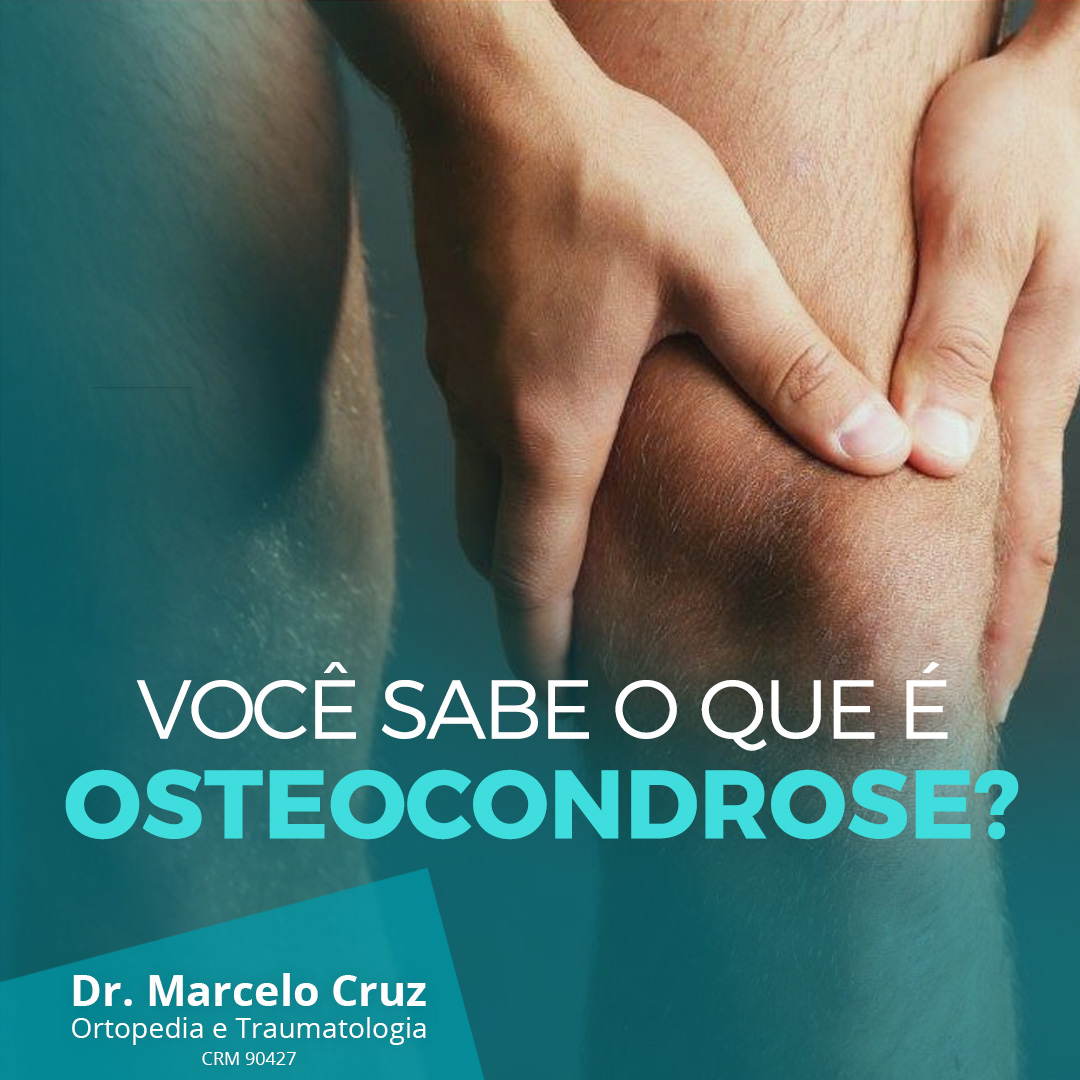 Você sabe o que é osteocondrose? - Dr. Marcelo Cruz